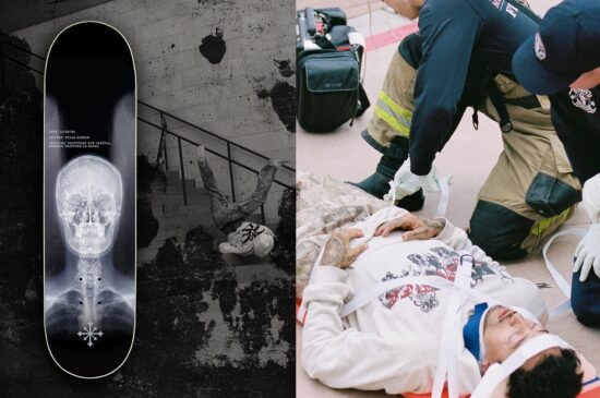 Nyjah Huston Hospitalized Again After Head Injury Following Last Year’s ...